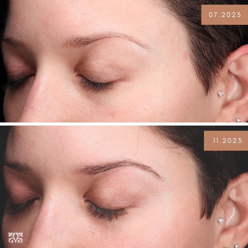 Obagi Nu-Cil Eyebrow Boosting Serum – We Love Skin