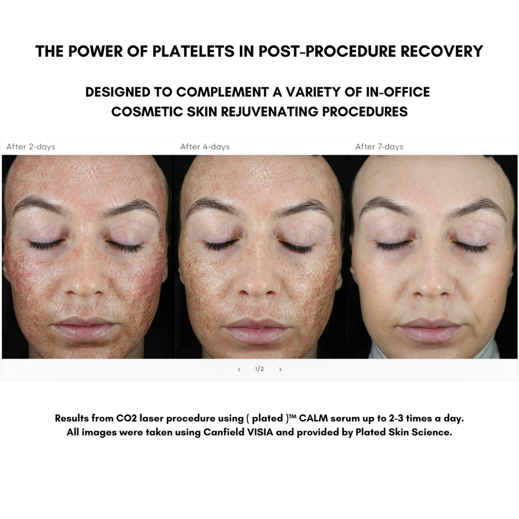 Plated Skin Science Calm Serum (Blue) – We Love Skin