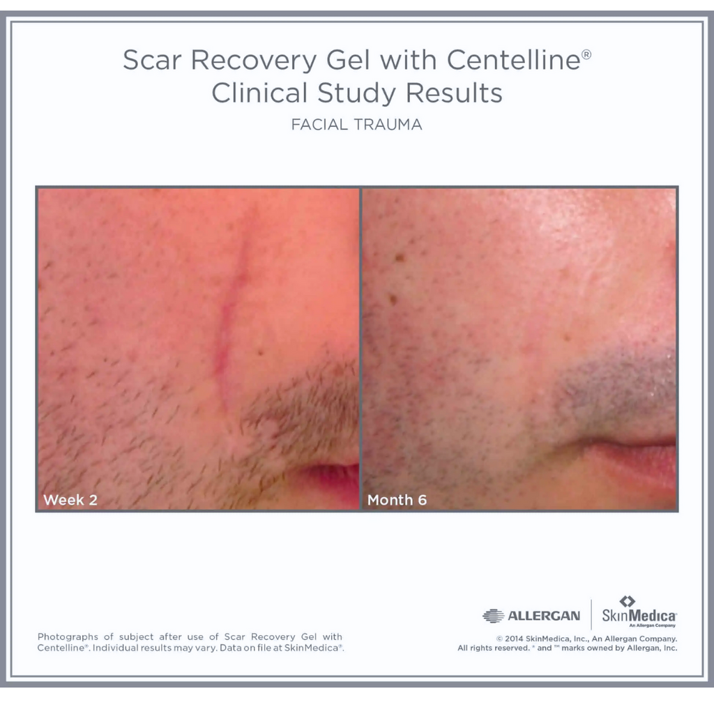 SkinMedica Scar Recovery Gel – We Love Skin